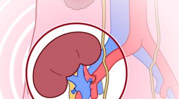 Clinical Kidney, Pancreas and Islet Transplantation | My Mooc