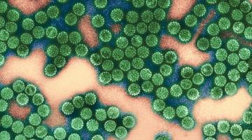 Viruses and Human Cancers | My Mooc