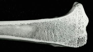 Cellular Solids Part 2: Applications in Medicine | My Mooc