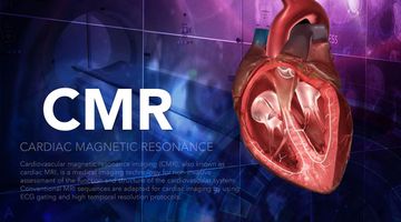 Advanced Cardiac Imaging: Cardiac Magnetic Resonance (CMR) | My Mooc